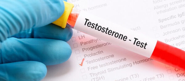What You Need to Know About Testosterone Levels in Men and Women
